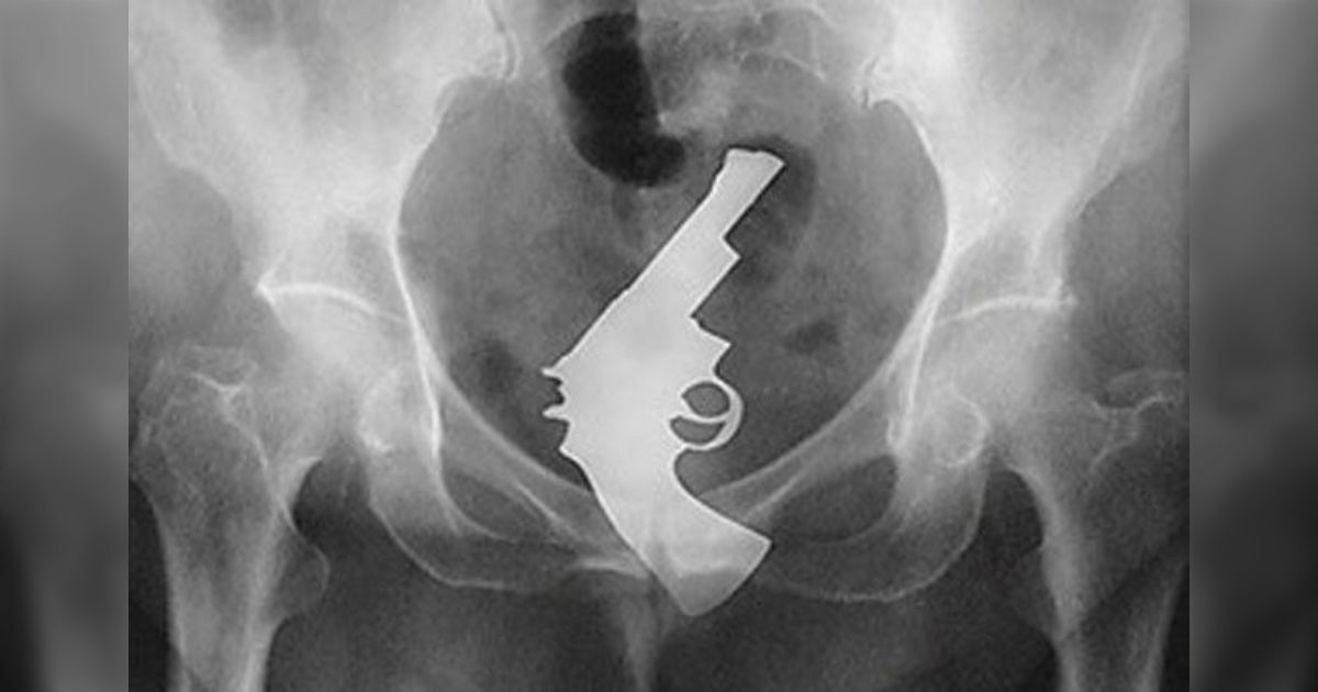 ブラギガス以上に危険な形状を持つ、AmazonにR18指定されたレゴが凄い - posfie